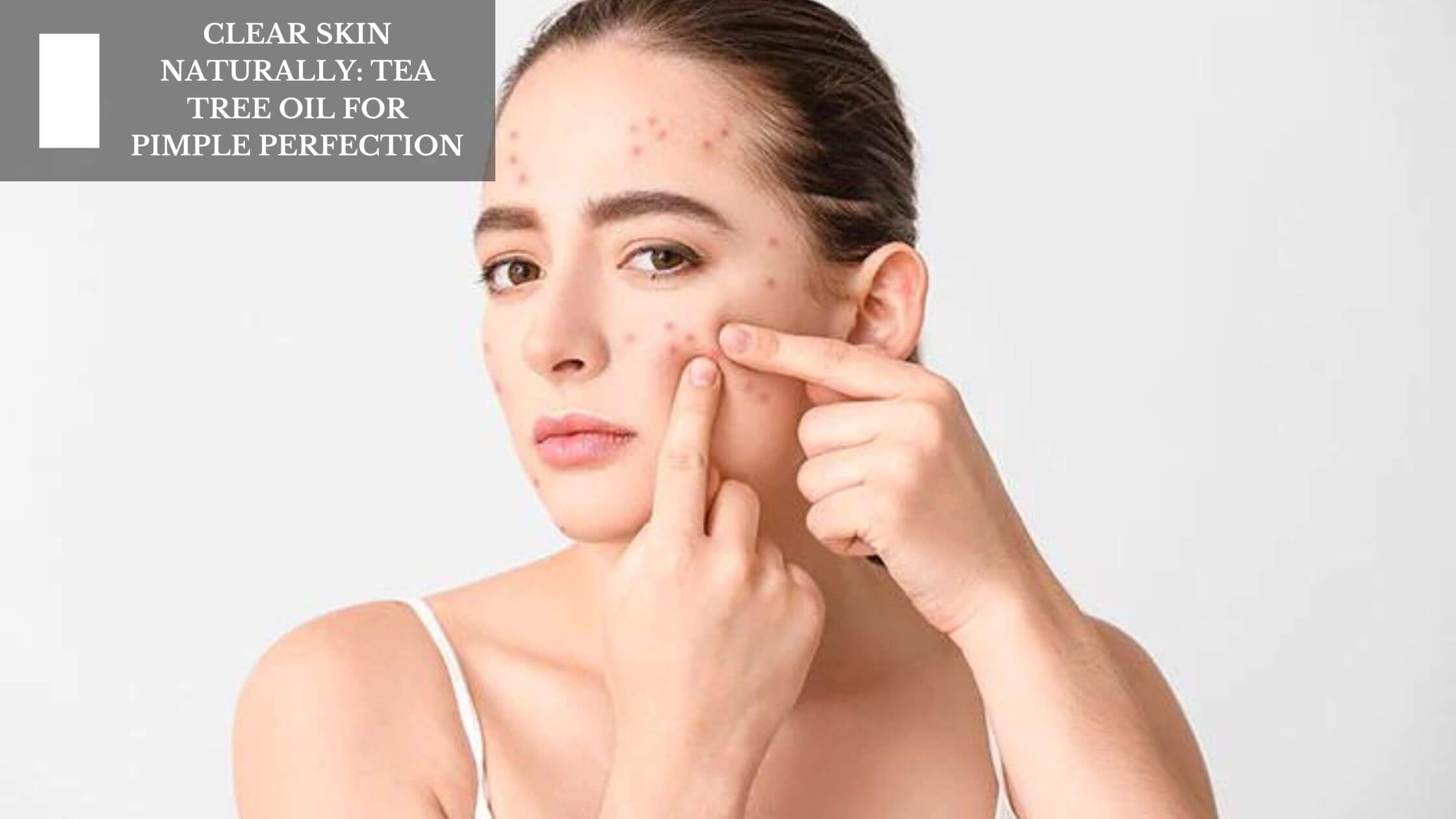 Clear Skin Naturally: Tea Tree Oil For Pimple Perfection – Moksha ...