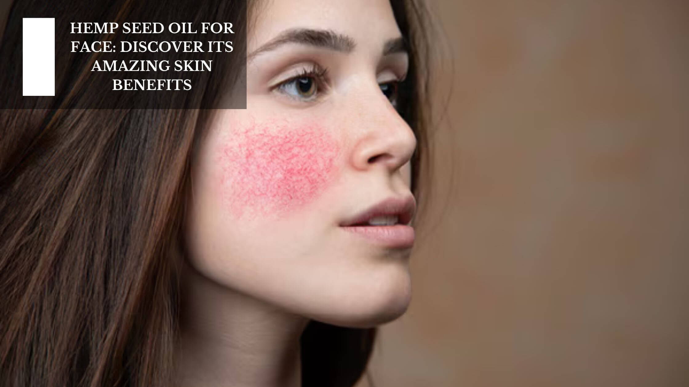 Hemp Seed Oil For Face: Discover Its Amazing Skin Benefits – Moksha ...
